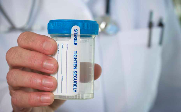 3 Types of workplace drug testing - Top Entrepreneurs Podcast ...